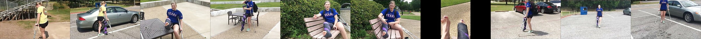 Free Leg Cast Porn Videos Xhamster 7927